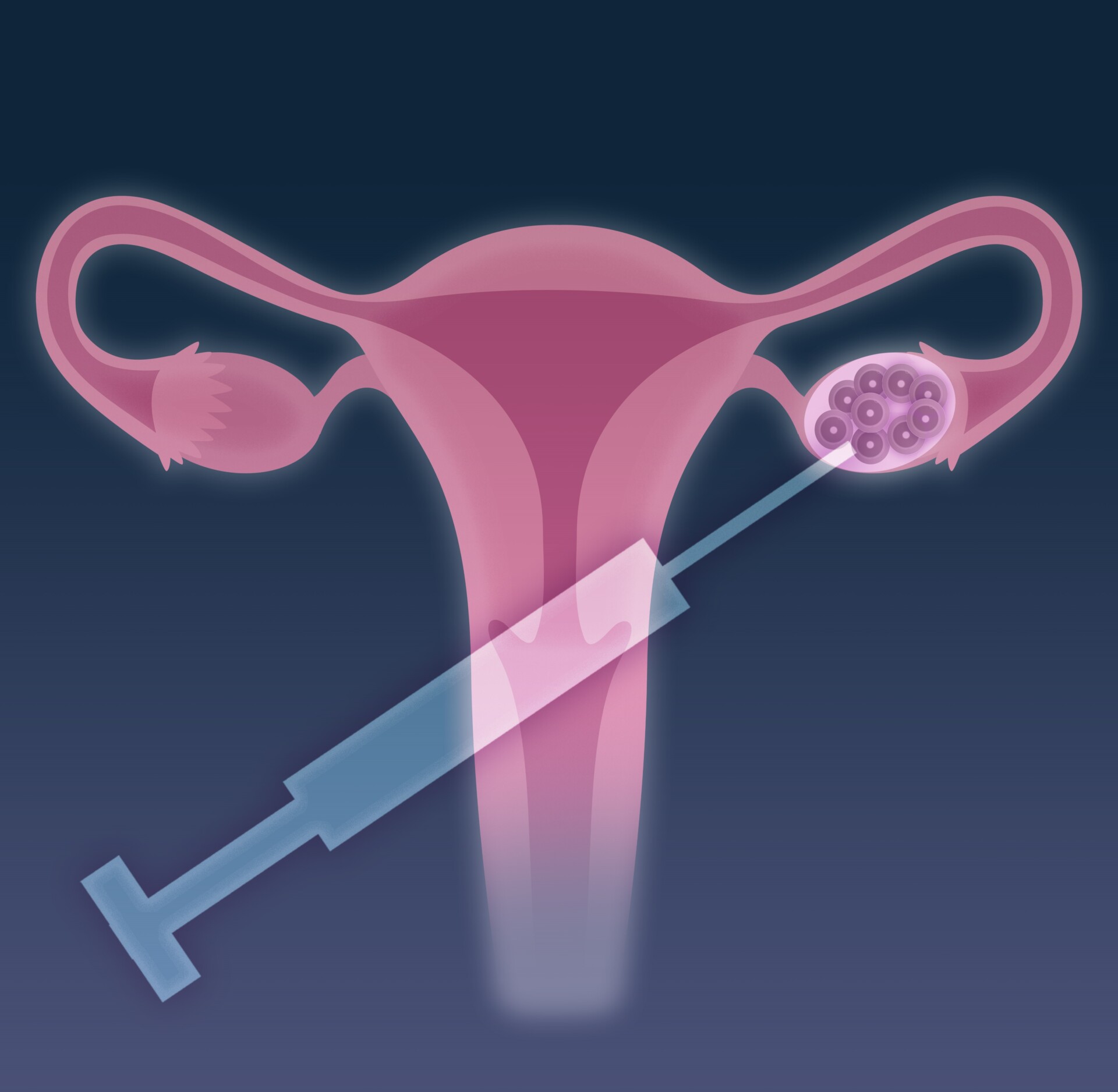 Safety and effectiveness of repeated ovarian hyperstimulation cycles ...